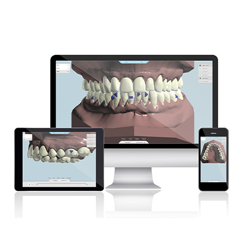 smart moves® clear aligners – clear aligners